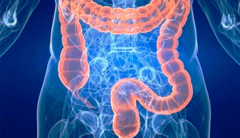 Colon irritabile: cause, sintomi e terapie – BenessereDiTutti.it